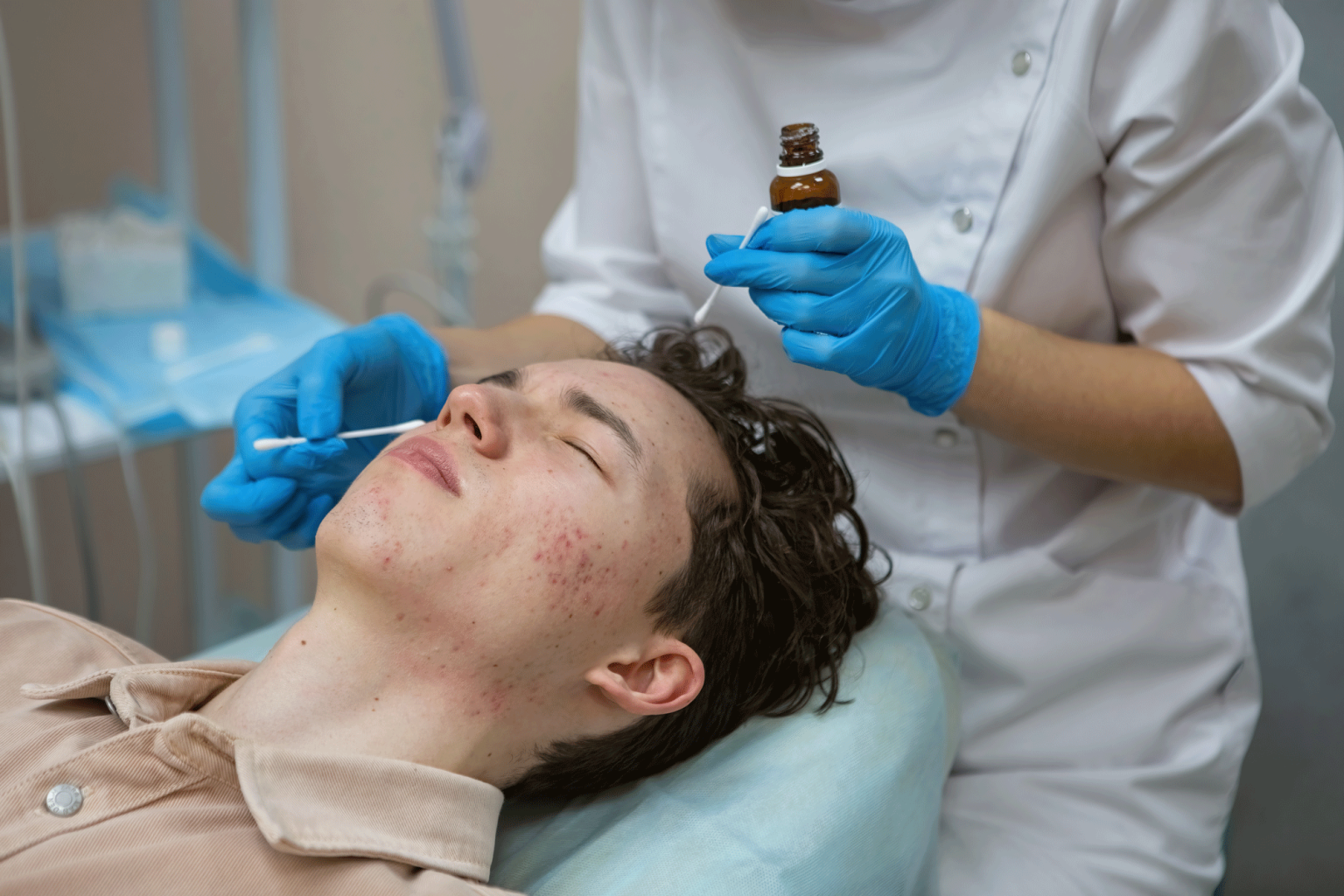 Acne - Cathedral Dermatology