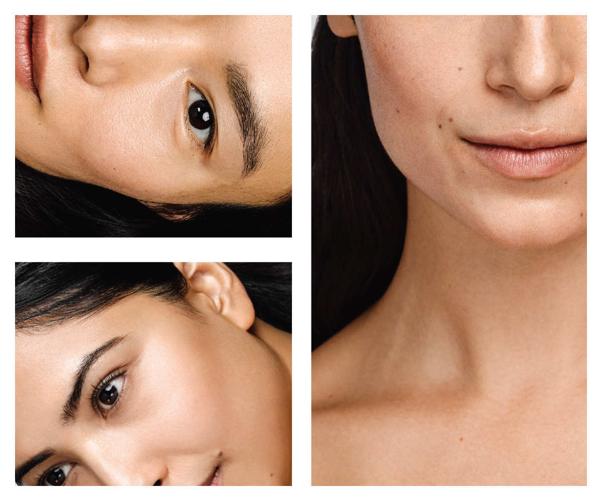 Professional Skin Peels - Cathedral Dermatology